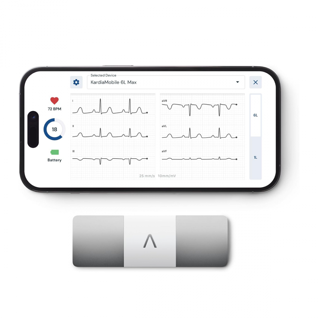 KardiaMobile 6L Max เครื่องบันทึก EKG 6-Lead with 12-Month Subscription